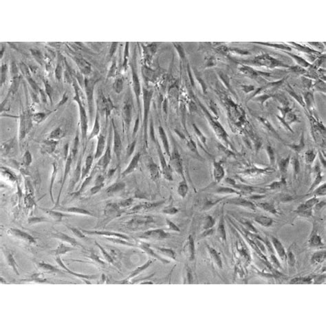 Human Adipose Derived Stem Cells Adscs Type 1 Diabetes