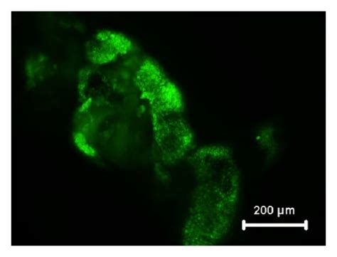 Corneal Endothelial Cell Sheet Immediately After Retrieval By