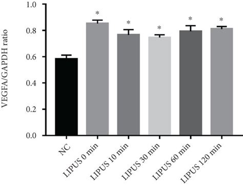Lipus Activated The Erk Vegfa Pathway In Adscs A Western Blot