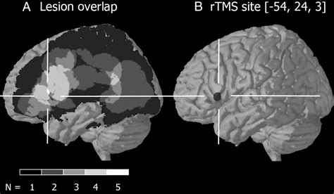 Ventrolateral Prefrontal Cortex