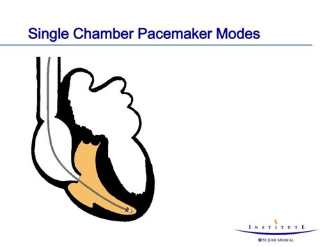 Ppt Nbg Pacemaker Code Powerpoint Presentation Free Download Id 3341196