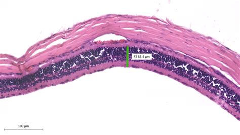 Preparation And Analysis Of Histological Slides Of Rat And Mouse