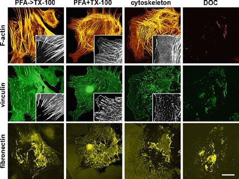 3 Different Permeabilization Procedures In Combination With Pfa Download Scientific Diagram