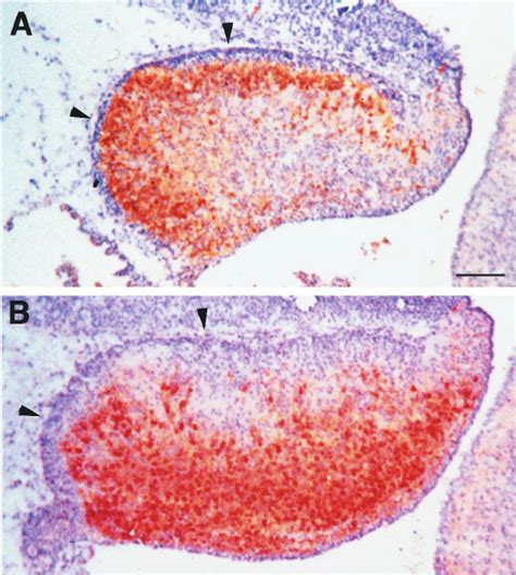 Calbindin Staining Of Sagittal Sections From E18 5 Cerebellum Reveals Download Scientific