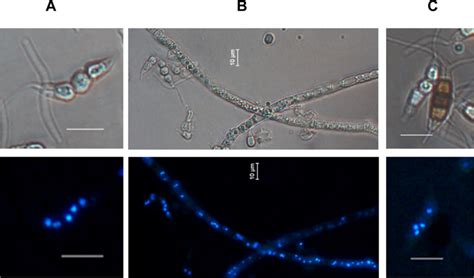 Dapi Staining For Detection Of The Nucleus In The Conidia A A Download Scientific Diagram