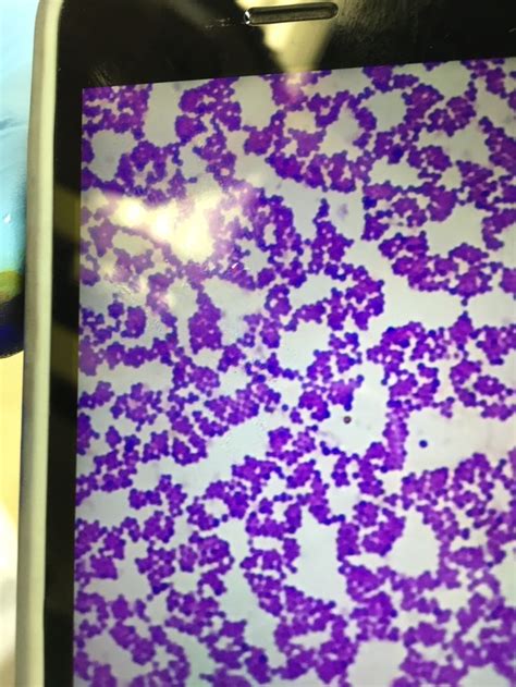 Cocci Clusters Of Staphylococcus Gram Positive USC Positivity Sprinkles Cluster