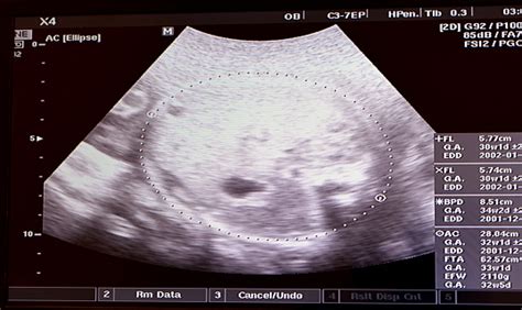 건강한 태아를 보여주는 임산부의 자궁 초음파 검사 임신 중 산모 초음파 임신 추적 관찰 및 태아 건강 개념 초음파 건강 검진 질에 대한 스톡 사진 및 기타 이미지 Istock