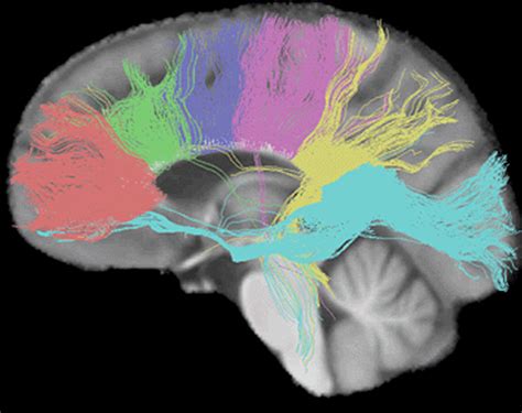 Corpus Callosum Definition Anatomy And Function