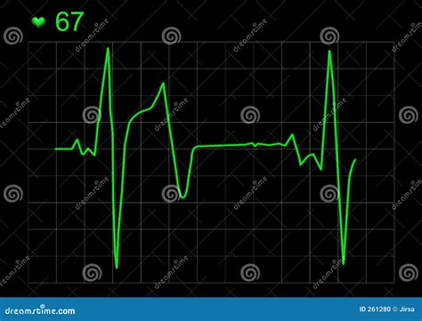 ECG Graph Stock Illustration Illustration Of Hospital