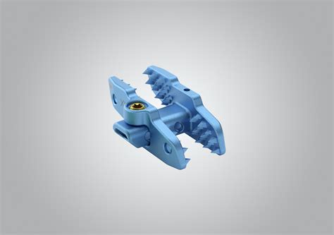 Spinous Process Orthofix