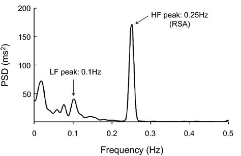A Schematic Representation Of Spectral Analysis Of Heart Rate Variability Download Scientific