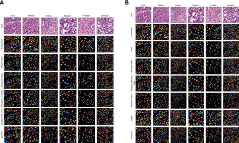 Frontiers Densely Convolutional Spatial Attention Network For Nuclei Segmentation Of