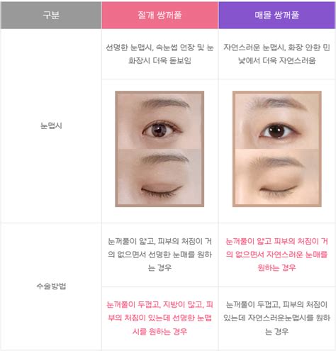 매몰 쌍꺼풀 더고운 성형외과 의원