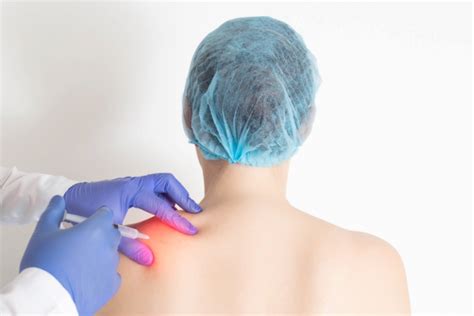 Check Out How Long Do Trigger Point Injections Last