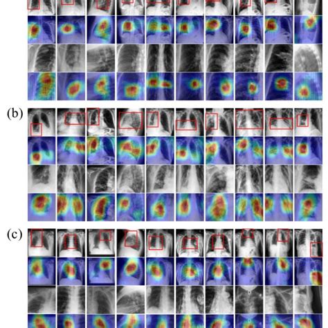 Prediction Performance Of Models Trained On The Chexpert Dataset For