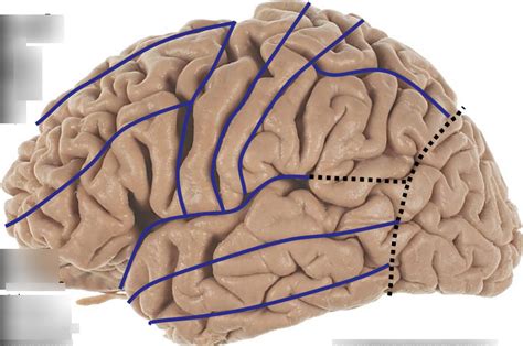 The Lateral Brain Diagram Quizlet