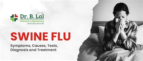 What Is Swine Flu Symptoms Causes Diagnosis And Treatment