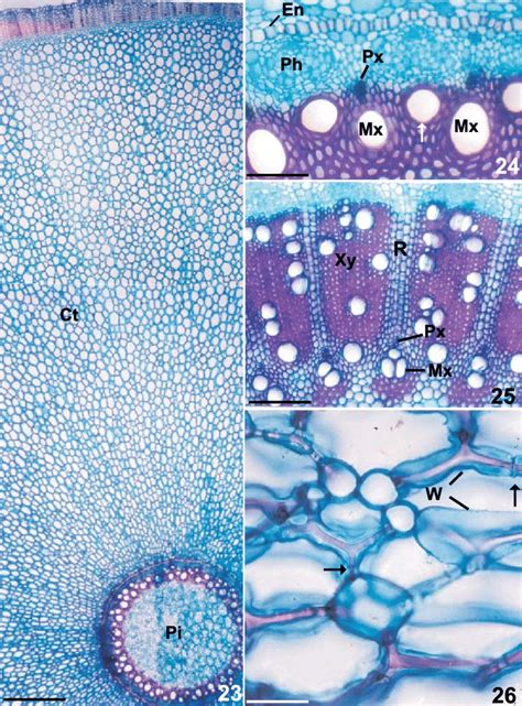 Cross Sections Of The Roots Of Rhizophora Mangle Fig 23 Adventitious