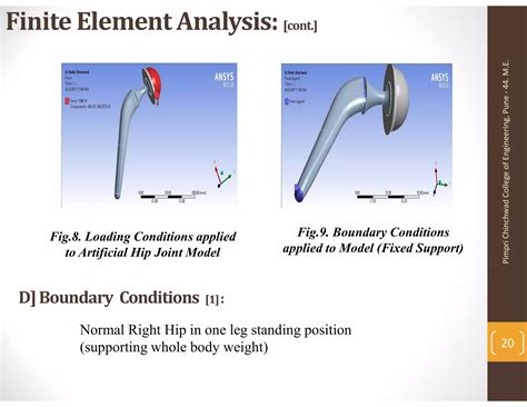 Fatigue Life Estimation Of Human Artificial Hip Joint Based On Modeling And Simulation Ppt