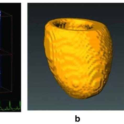Cardiac Fiber Orientation Estimation Of An In Vivo Beating Heart A 3d Download Scientific