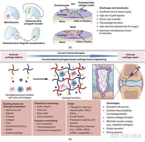 香港中文大学联合瑞士ao骨科研究所综述：用于关节软骨组织工程的功能化水凝胶 中国工程院院刊engineering 知乎