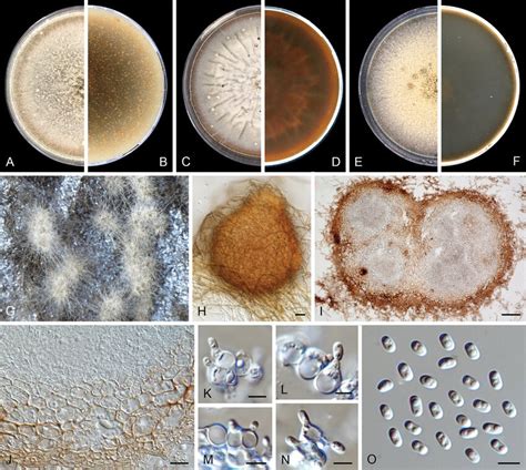Didymella Degraaffiae Cbs 144956 A B Colony On Oa Front And