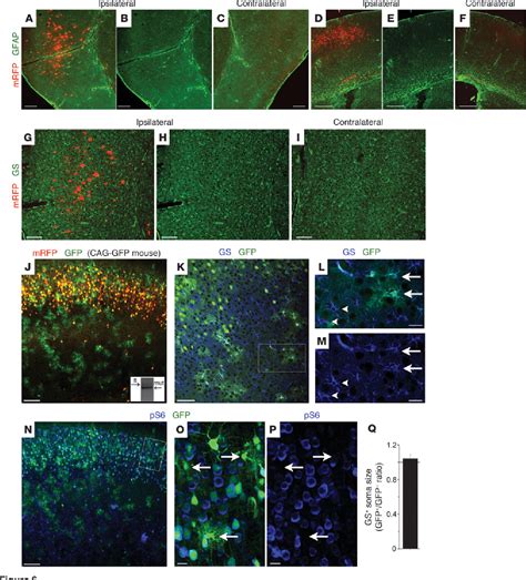 Figure 1 From Single Cell Tsc1 Knockout During Corticogenesis Generates Tuber Like Lesions And