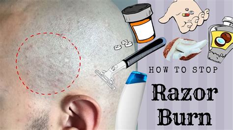 Razor Burn Bumps How To Treat Razor Burn Reccau