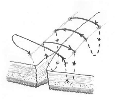 Suture Patterns Cushing In Cows Bovis Vetlexicon