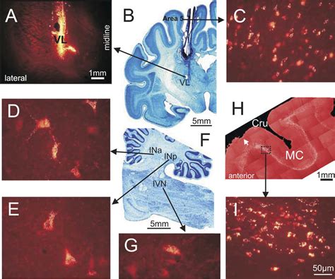 Cerebellar And Cortical Neurons Labeled With Fluorescent Beads In Cat Download Scientific