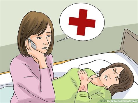 3 Ways To Get Rid Of Hives WikiHow Health 3 Ways To Get Rid Of Hives WikiHow Health