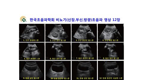 한국초음파학회