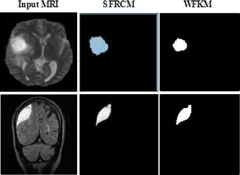 Visual Segmentation Results Of Soft Fuzzy Rough C Means Sfrcm 13 Download Scientific