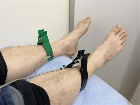 Latest Wireless Cardiogram Equipment Electrode Of Ecg Tracing Of Ill