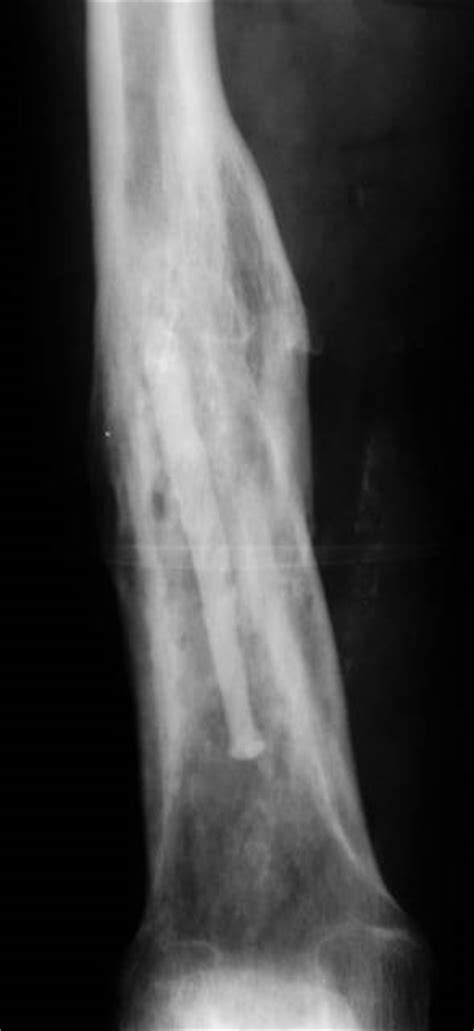 Sumers Radiology Blog