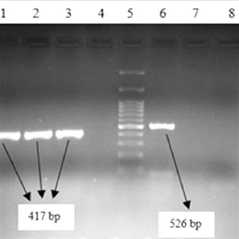 Results Of Antibiogram Test Antibiotics Resistant Sensitive Download Table