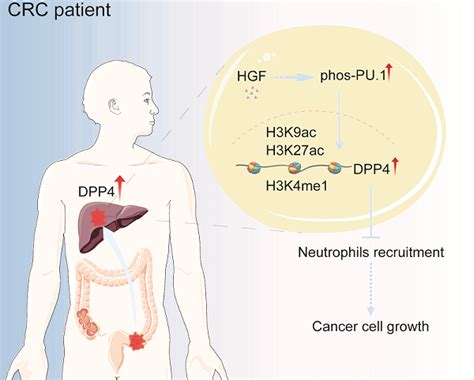 沈西凌 卜鹏程团队发现肝脏微环境重编程肿瘤细胞促进结直肠癌肝转移 研究