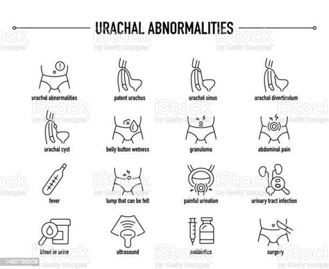 Urachal Abnormalities Vector Icon Set Line Editable Medical Icons Stock