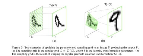 Spatial Transformers Valentyn1997xray Github Wiki