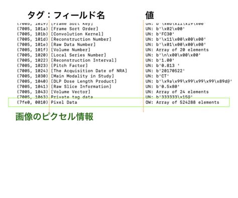 dicomデータとはなにか｜医療のためのpythonプログラミング