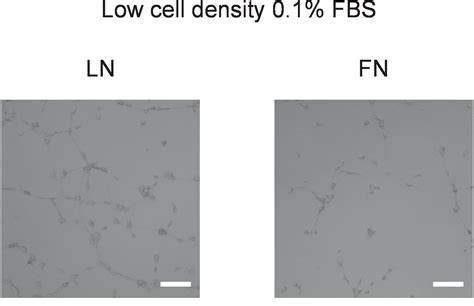 Induction Of Endothelial Differentiation In Cardiac Progenitor Cells