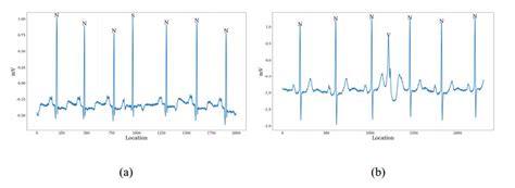 Arrhythmia Classification Based On Multi Feature Multi Path Parallel Deep Convolutional Neural