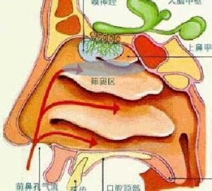 慢性鼻炎 搜狗百科
