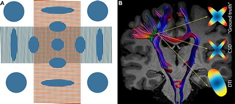 Frontiers Diffusion Tensor Imaging Biomarkers To Predict Motor