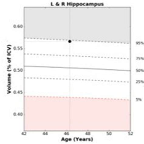 An Example Of Neuroquant® Numeric Data Acquisition And 3 Dimensional