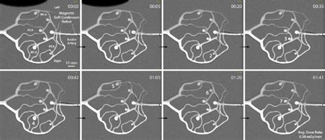 Magnetic Soft Continuum Robot Selectively Reaching The Aneurysms Download Scientific Diagram