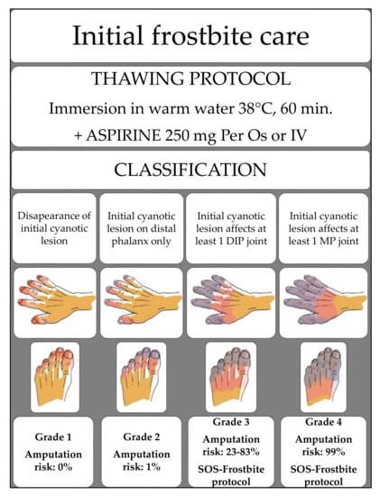 Severe Frostbite Amputation
