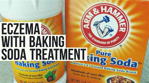How To Soothe Eczema With Baking Soda