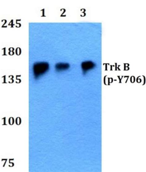 Trkb P Tyr705 0 1 Mg