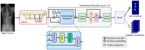 Bioengineering Free Full Text Spinehrformer A Transformer Based Deep Learning Model For